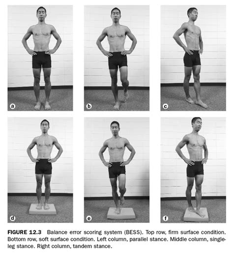 Concussion Identification Image Physical Therapy
