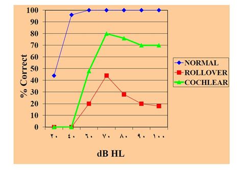 B244 Speech Audiometry
