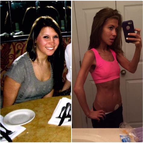 Throwback Thursday Ed Version Eating Disorder Support Forum