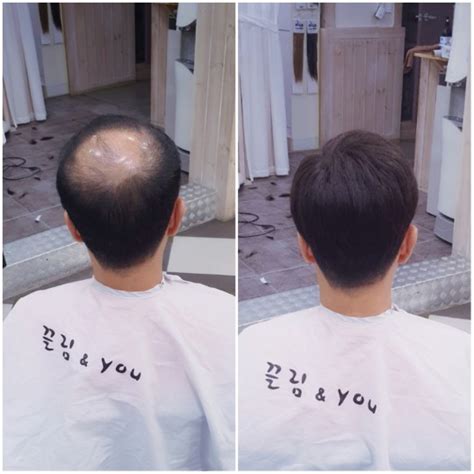 갤러리 춘천가발붙임머리끌림앤유