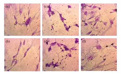 Optical Micrographs At 50× Of Magnification Of The Morphology Of