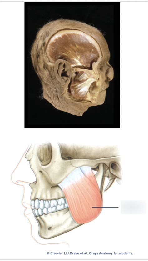 Masseter Diagram Quizlet