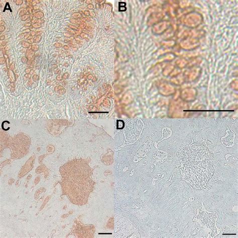 Uea I Lectin Staining Of Normal Colonic Mucosa And Tumors Of 24 Week Download Scientific