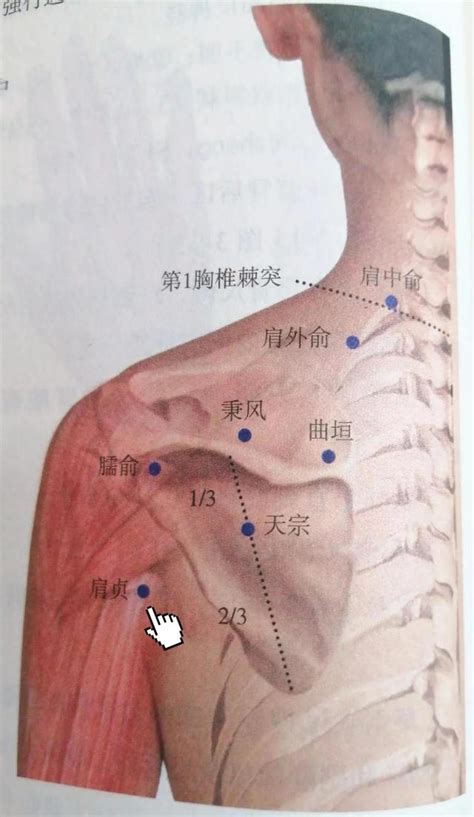 頸椎病，這三處必有結節！一招輕鬆化解 每日頭條
