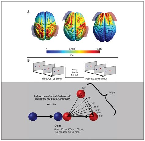 A Transcranial Direct Current Stimulation Tdcs Conditions Showing