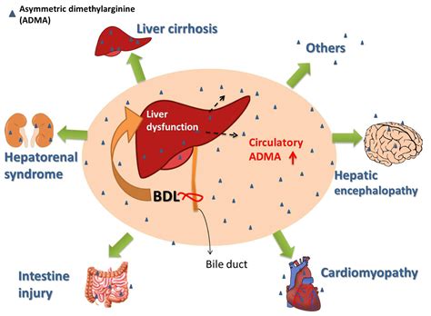 Common Bile Duct Model