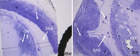 Subarachnoid Space Of The Optic Nerve Sheath Semi Thin Sections Om Download Scientific