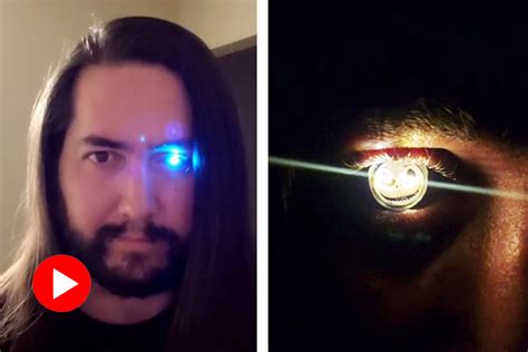 Eye Man Turns His Eye Into A Flashlight After Losing It To Cancer