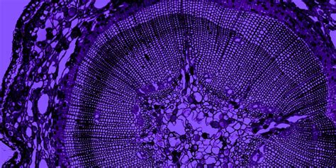 Calyx On Linkedin Partnering For Rare Disease Clinical Trial Success