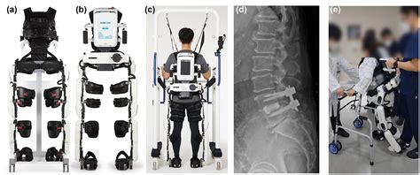 Frontiers New Protocol For Early Robot Assisted Gait Training After Spinal Surgery