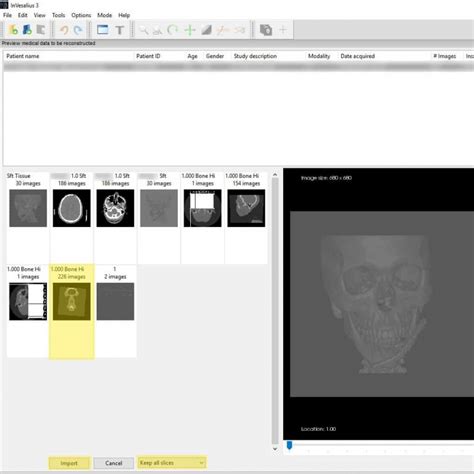 how to 3d print a dicom file step by step tutorial medimodel