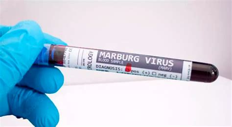 Cómo Se Transmite El Virus De Marburgo Y Cuáles Son Los Síntomas Según