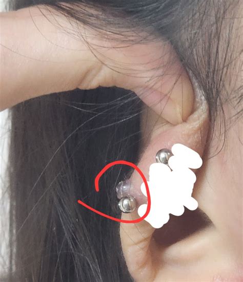피어싱 한 곳 옆에 뭐가 났어요 지식in