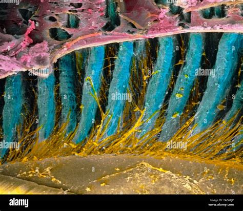 Ciliary Processes Of The Eye Coloured Scanning Electron Micrograph