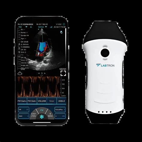 Portable Ultrasound Scanner Lpus A19│waterproof Ultrasound Probe