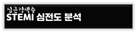 ️ ️stemi 심전도 분석 St분절 상승에 따른 심근경색