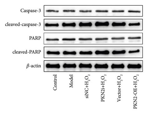 Pkn2 Overexpression Prevents H2o2 Induced Apoptosis Of Pc12 Cells A