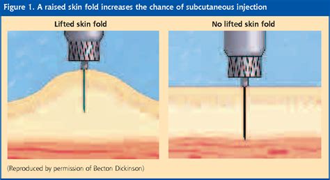 Figure 1 From Subcutaneous Insulin Injection Technique Semantic Scholar
