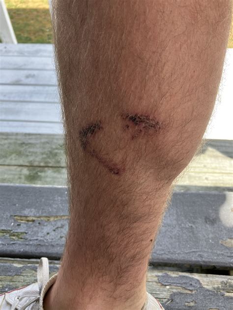 River Eel Bite At Victoria Mcbrien Blog