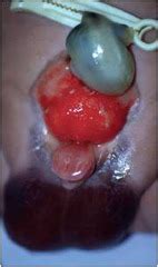 Visual Rec Flashcards Quizlet