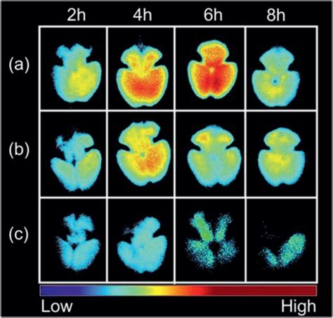 A Schematic Depiction Of The Glymphatic Pathway This Diagram Shows