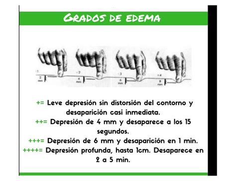 Grados De Edema Udocz
