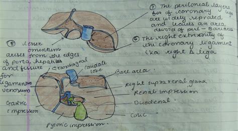 Medicowesome Peritoneal Ligaments Of Liver