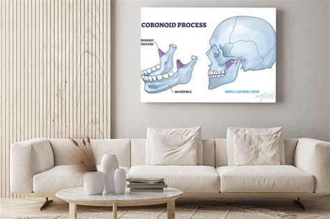 Coronoid Process Anatomy With Isolated Bone And Skull View Outline
