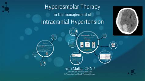 Hyperosmolar Therapy By Sam Matta On Prezi