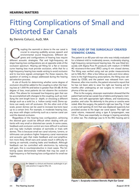 Pdf Fitting Complications Of Small And Distorted Ear Canals