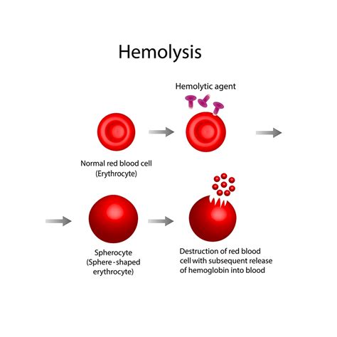 Hemolysis Testing The Armoloy Corporation