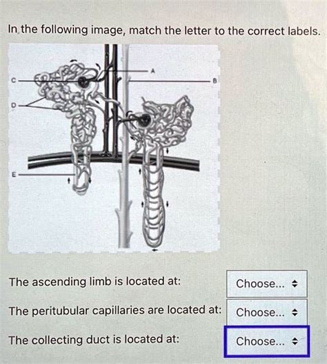 solved in the following image match the letter to the correct labels