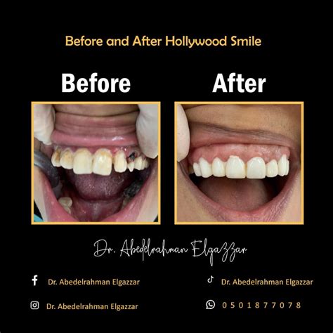 Abdelrahman Algazzar Posted On Linkedin