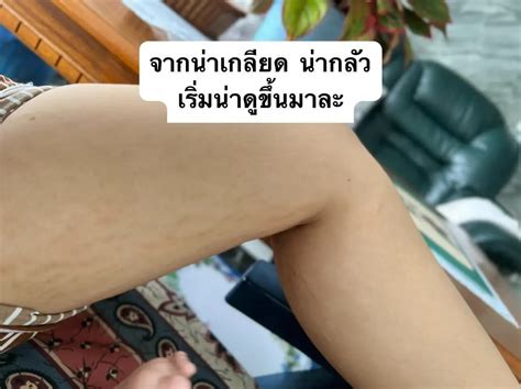 ดูสิรอยแตกหนักขนาดไหน แกลเลอรีที่โพสต์โดย 🅆🄰🅅🄴 Lemon8