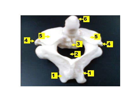 Aandp1 Axis C2 Diagram Quizlet