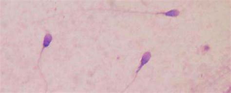 Scientists Have Just Made Sperm Out Of Human Skin Cells Sciencealert