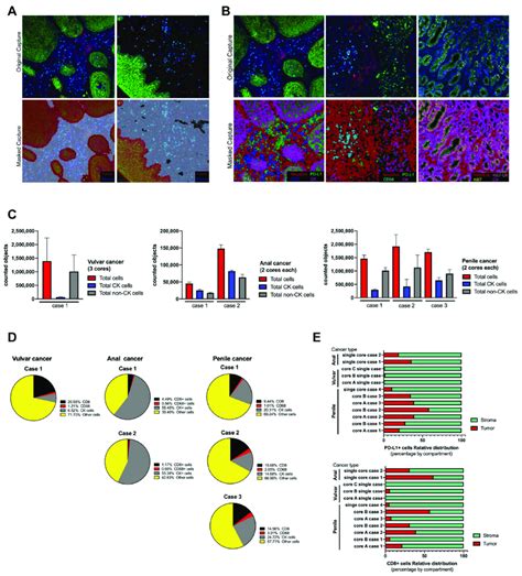 Tissue Segmentation And Cell Phenotyping In Cases Series Of Anal