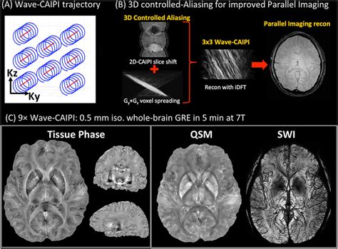 Wave Caipi Applied To High Resolution Qsm A Undersampled K Space Download Scientific Diagram