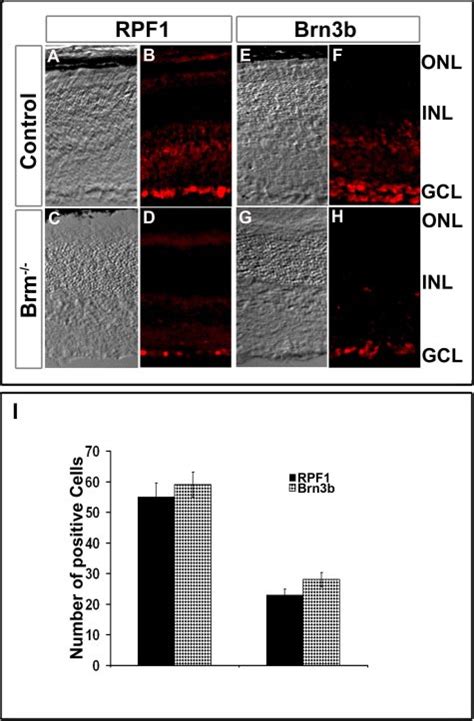 Rgcs In The Retina Of Brm Mice To Determine Whether Or Not Brm