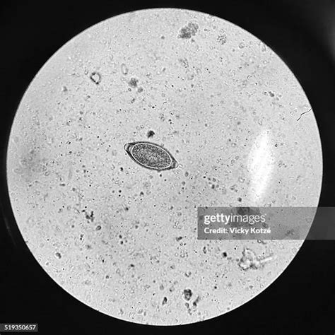 Worms Under Microscope Stock Fotos Und Bilder Getty Images