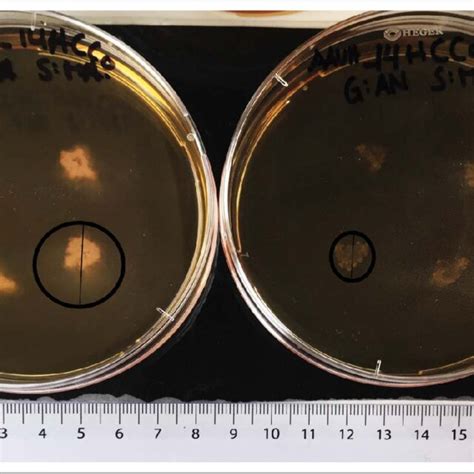 Images Of Soft BHI Agar Motility Plates Each Plate Has Four Zones Of