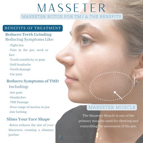 Dr Tmj Treatment With Neuromodulators Benefits 1 Stops Grindingclenching 2 Protects Your