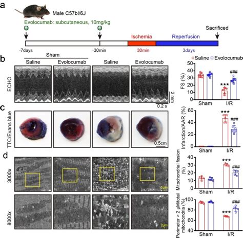 Basic Res Cardiol 大连医科大学附属第一医院张波教授团队揭示evolocumab保护心肌缺血 再灌注损伤的新机制 Medsci Cn