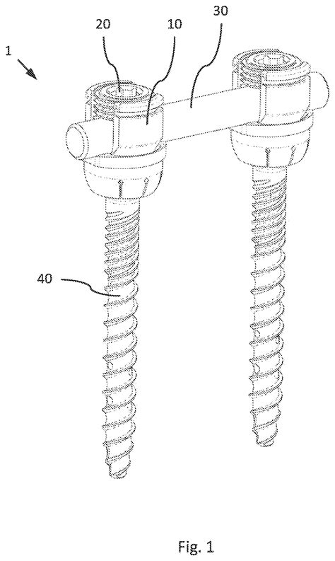 Modular Osteosynthesis Device For Vertebrae Eureka Patsnap