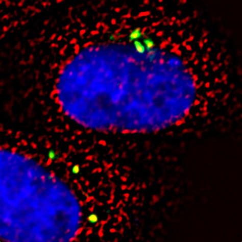 Jim Sweeney On Linkedin The Fungal Pathogen Candida Albicans