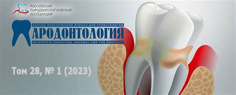 Журнал «Пародонтология». Том 28, N 1/2023 | Издательства # стоматология ...
