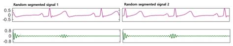 Data Independent Acquisition Based Bi Directional Deep Networks For Biometric Ecg Authentication