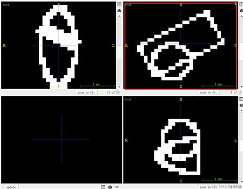 使用vtkimagestencil处理相交多边形出现空洞问题vtkimagestenciltoimage Csdn博客
