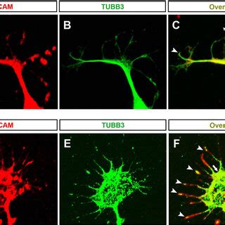 Subcellular Colocalization Of Dscam With Tubb In The Growth Cone Of