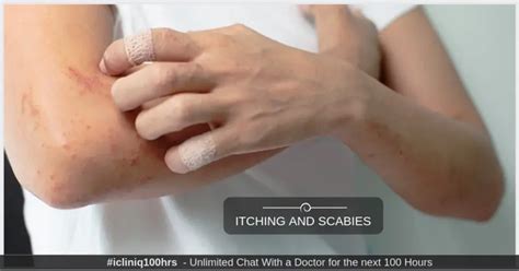 Does Scratching Scabies Make It Worse